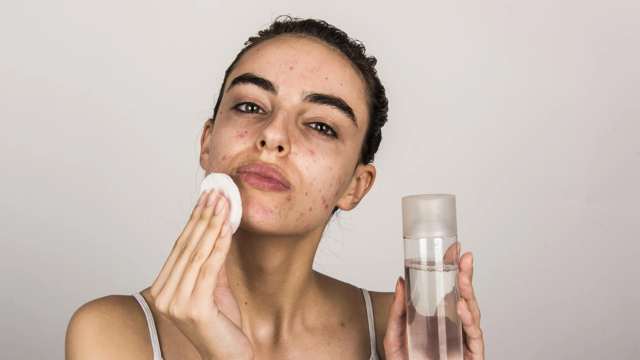 Skincare Routine for Sensitive Acne-Prone Skin: Gentle Care That Works ...